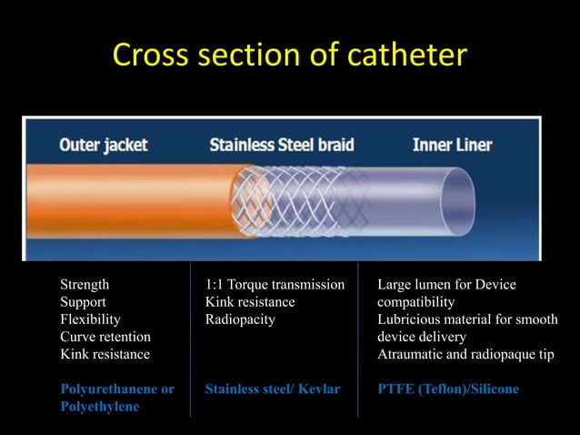 Choice of guiding catheters in PCI | PPTX