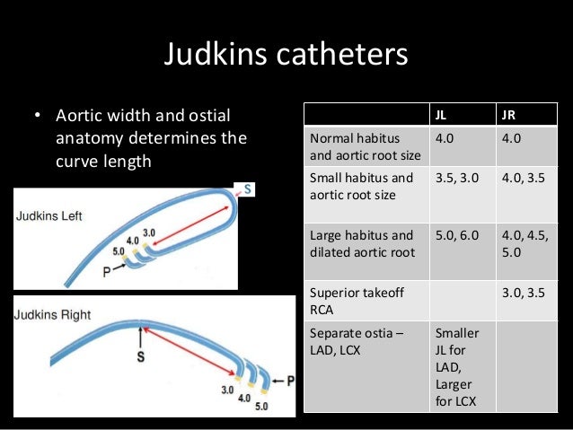 Choice of guiding catheters in PCI