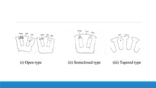 Design of stator & rotor for Wound Induction Motor | PPTX