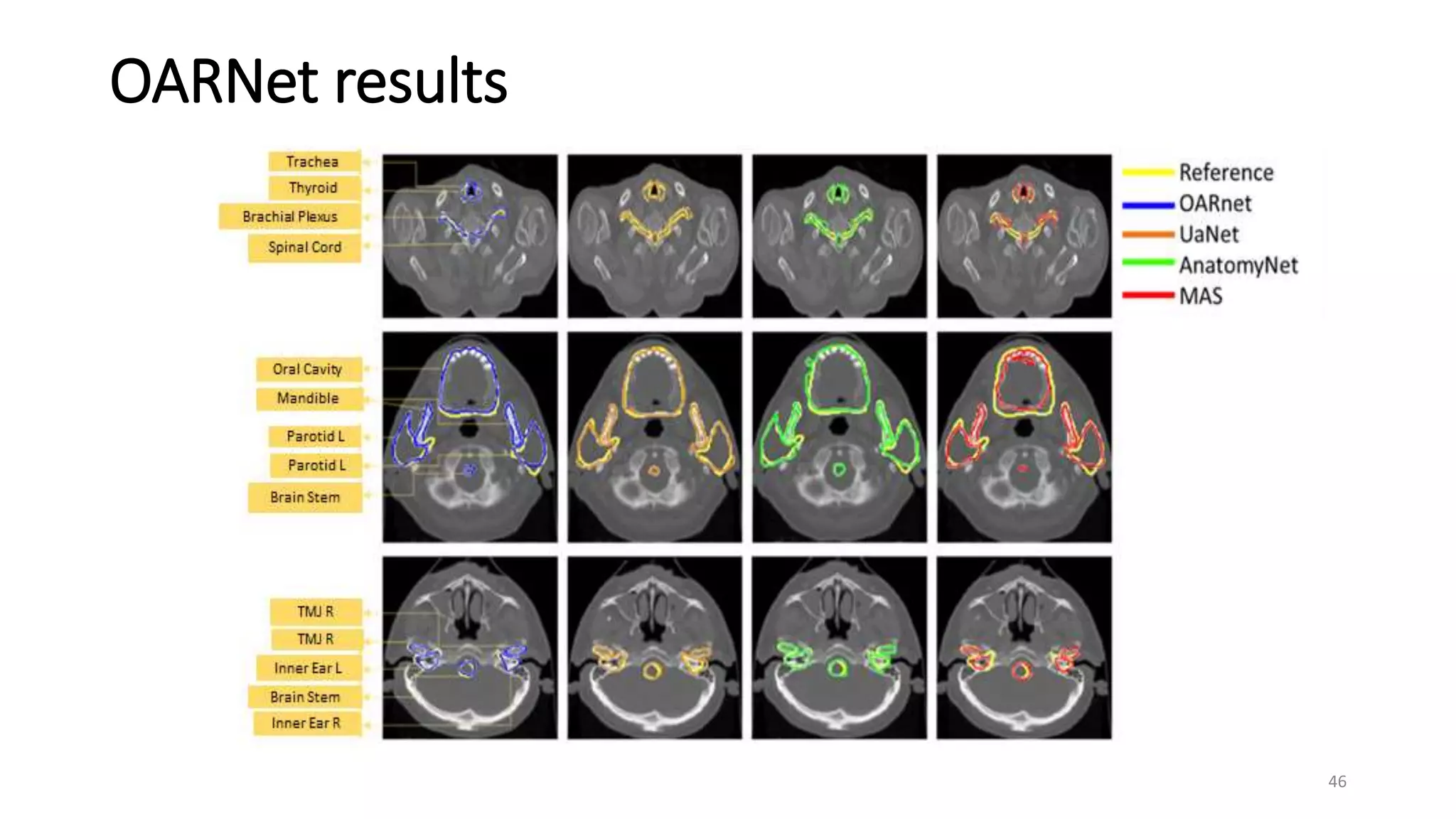 Artificial Intelligence in Radiation Oncology | PPTX