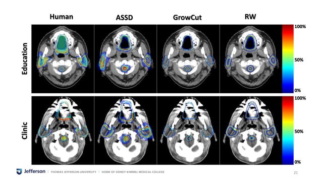 Artificial Intelligence in Radiation Oncology.pptx | Cancer | Diseases ...