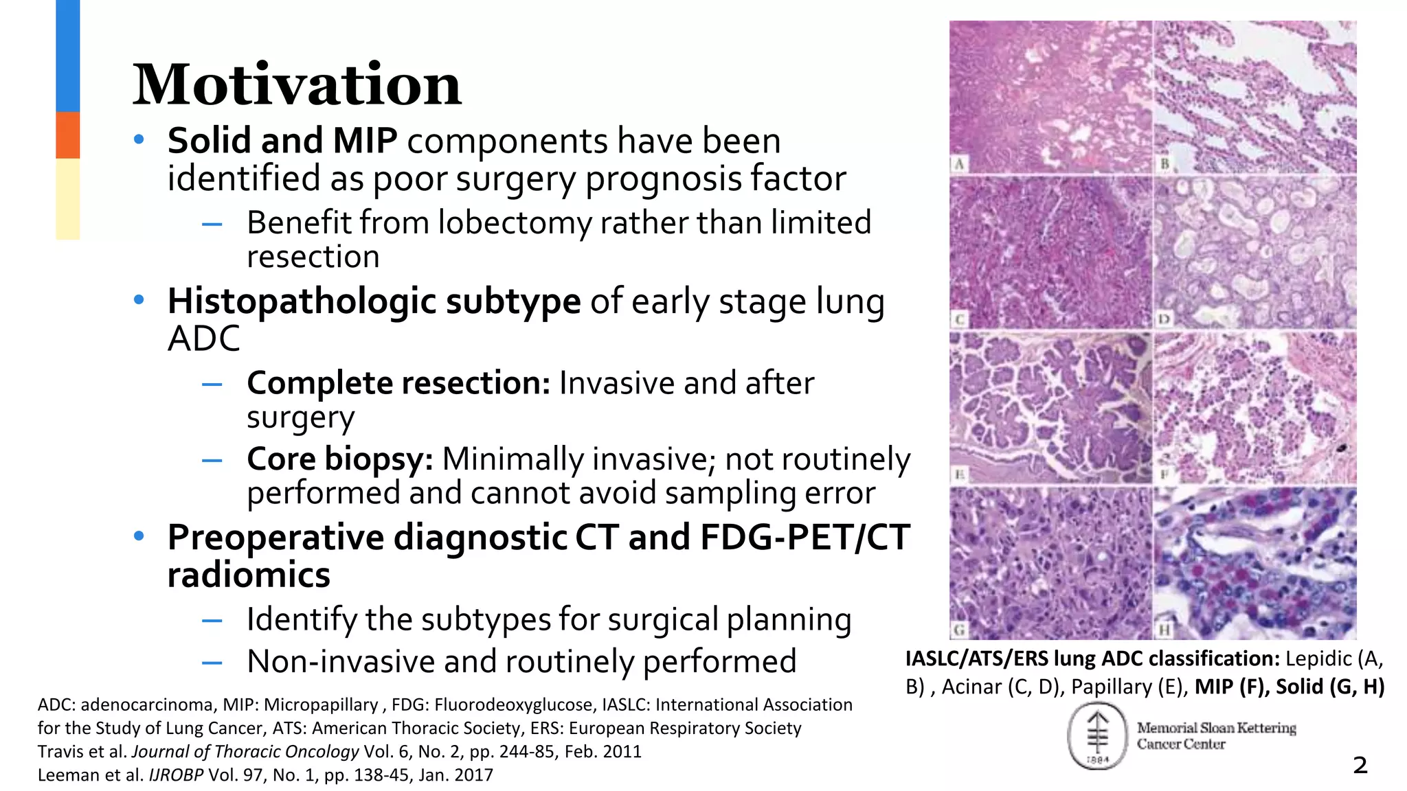 Aggressive Lung Adenocarcinoma Subtype Prediction Using FDG-PET/CT ...
