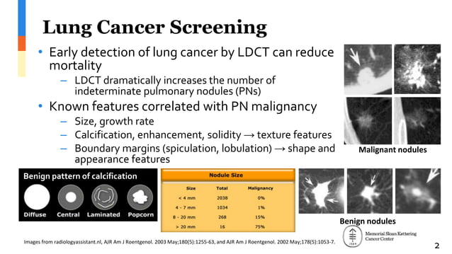 Radiomics Analysis of Pulmonary Nodules in Low Dose CT for Early ...