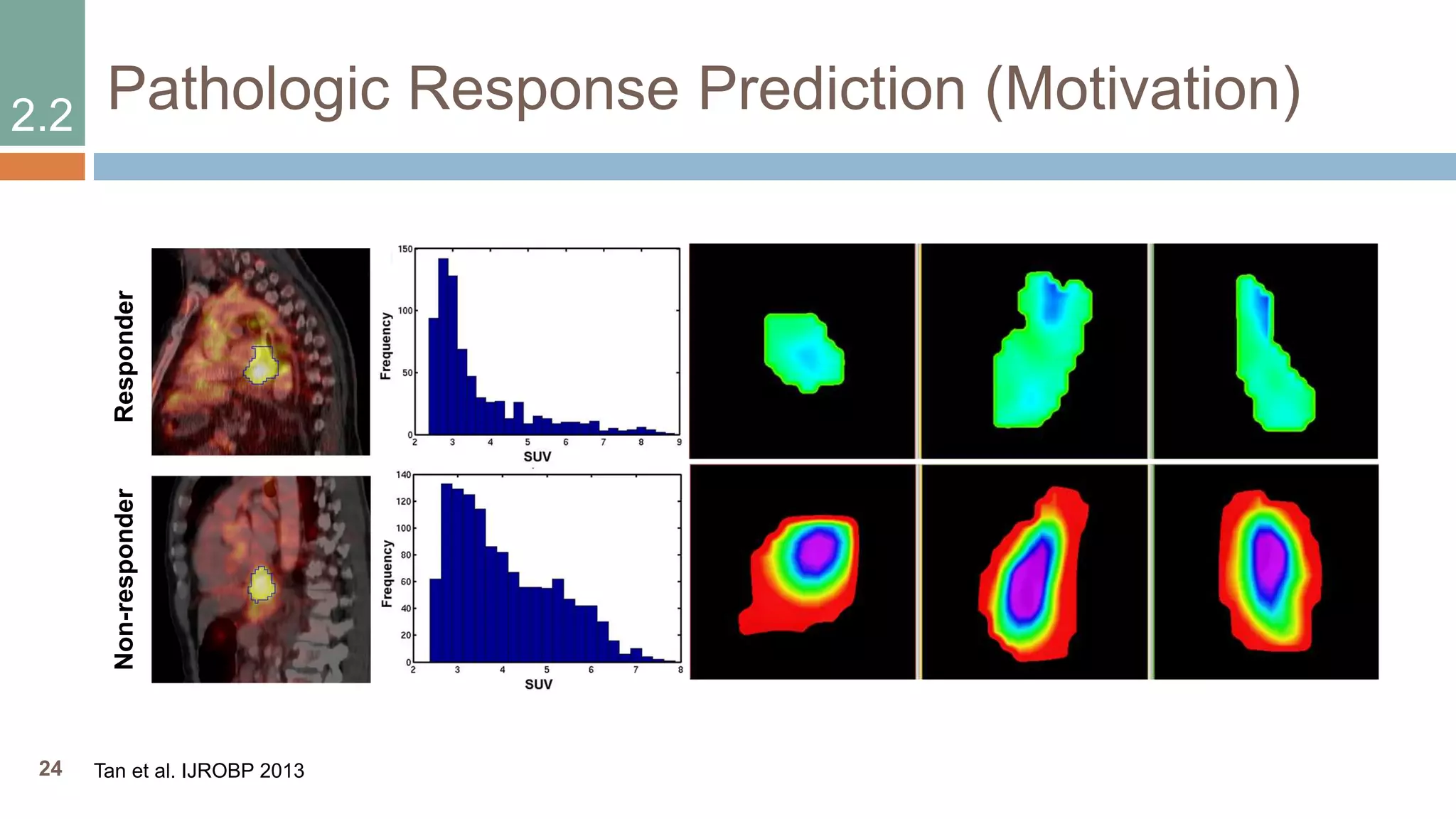 Quantitative Image Analysis for Cancer Diagnosis and Radiation Therapy ...