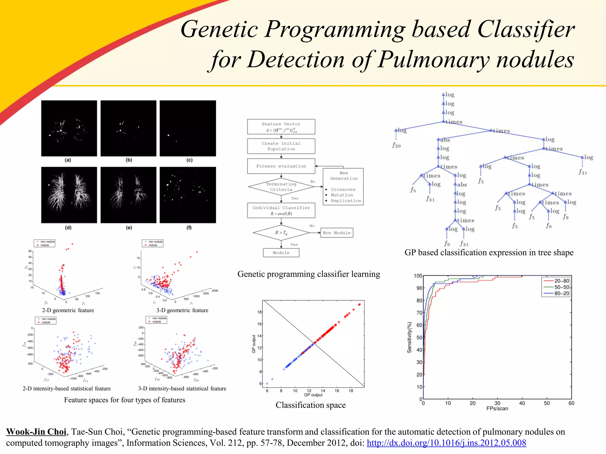 Computer Aided Detection Of Pulmonary Nodules In Ct Scans Ppt