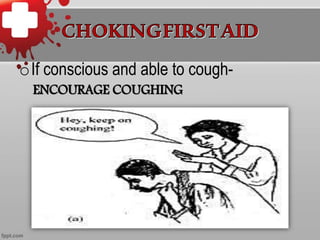 Choking | PPT