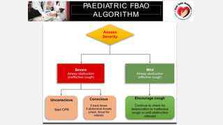 CHOKING.pptx | Free Download