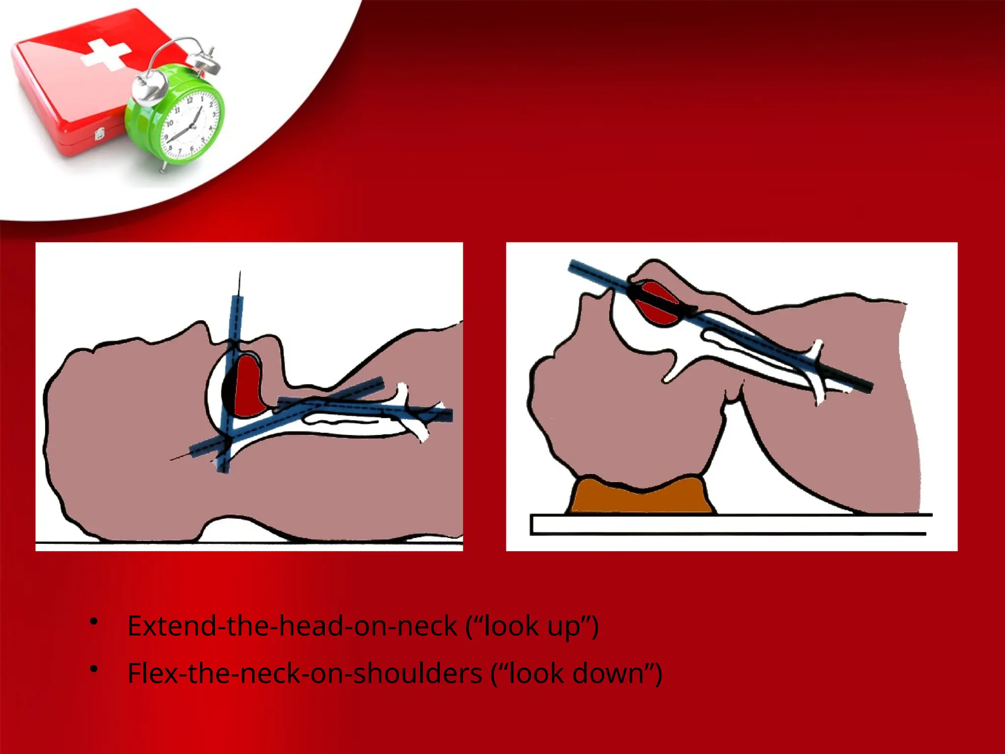 basic choking techniques and Basic airway junctions | PPTX