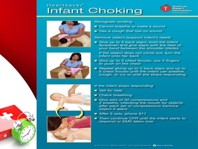 basic choking techniques and Basic airway junctions | PPTX