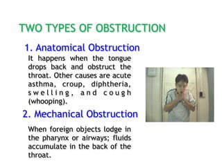 CHOKING (Final)_.pdf