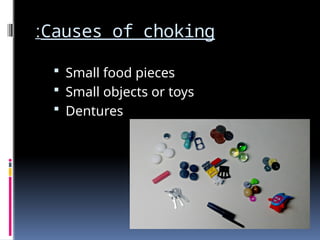 Choking Management, for a school student | PPTX