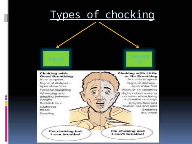 Choking Management, for a school student | PPTX