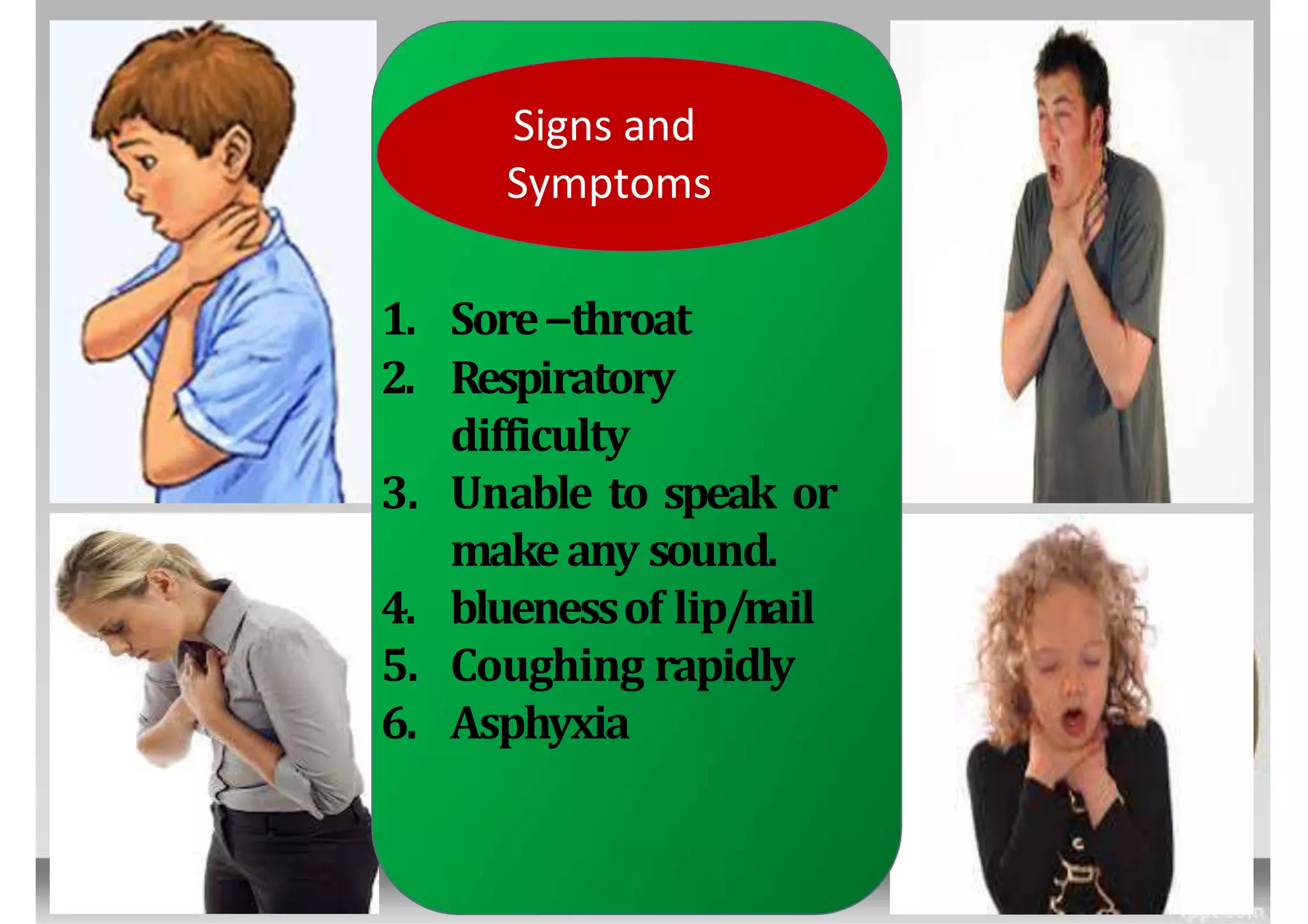 Choking in adult and child | PPTX