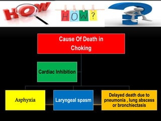 Choking ppt | PPTX