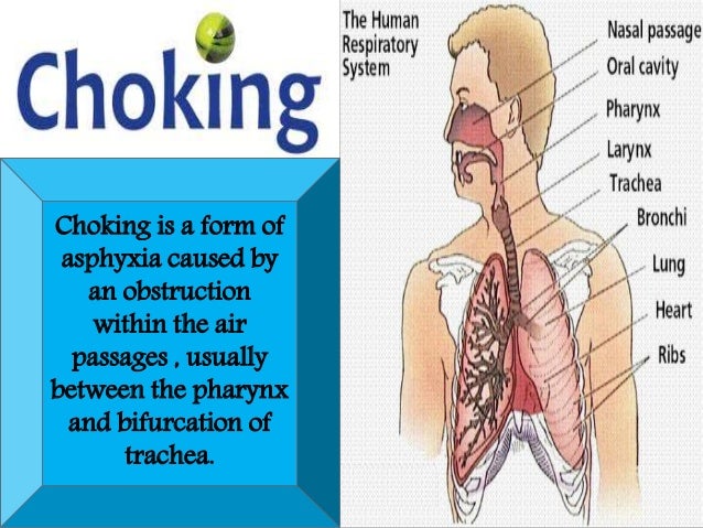 Choking ppt