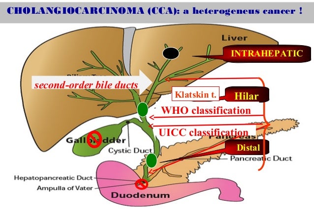 Il colangiocarcinoma: Presentazione Clinica, Diagnosi e Trattamento