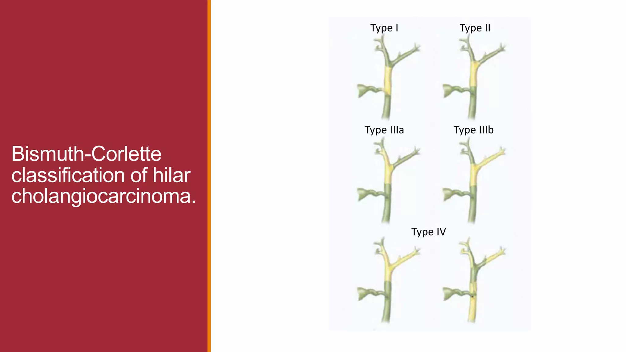 Cholangiocarcinoma: Pathology, diagnosis and treatment. | PPTX