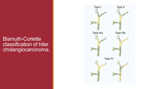 Cholangiocarcinoma: Pathology, diagnosis and treatment. | PPT