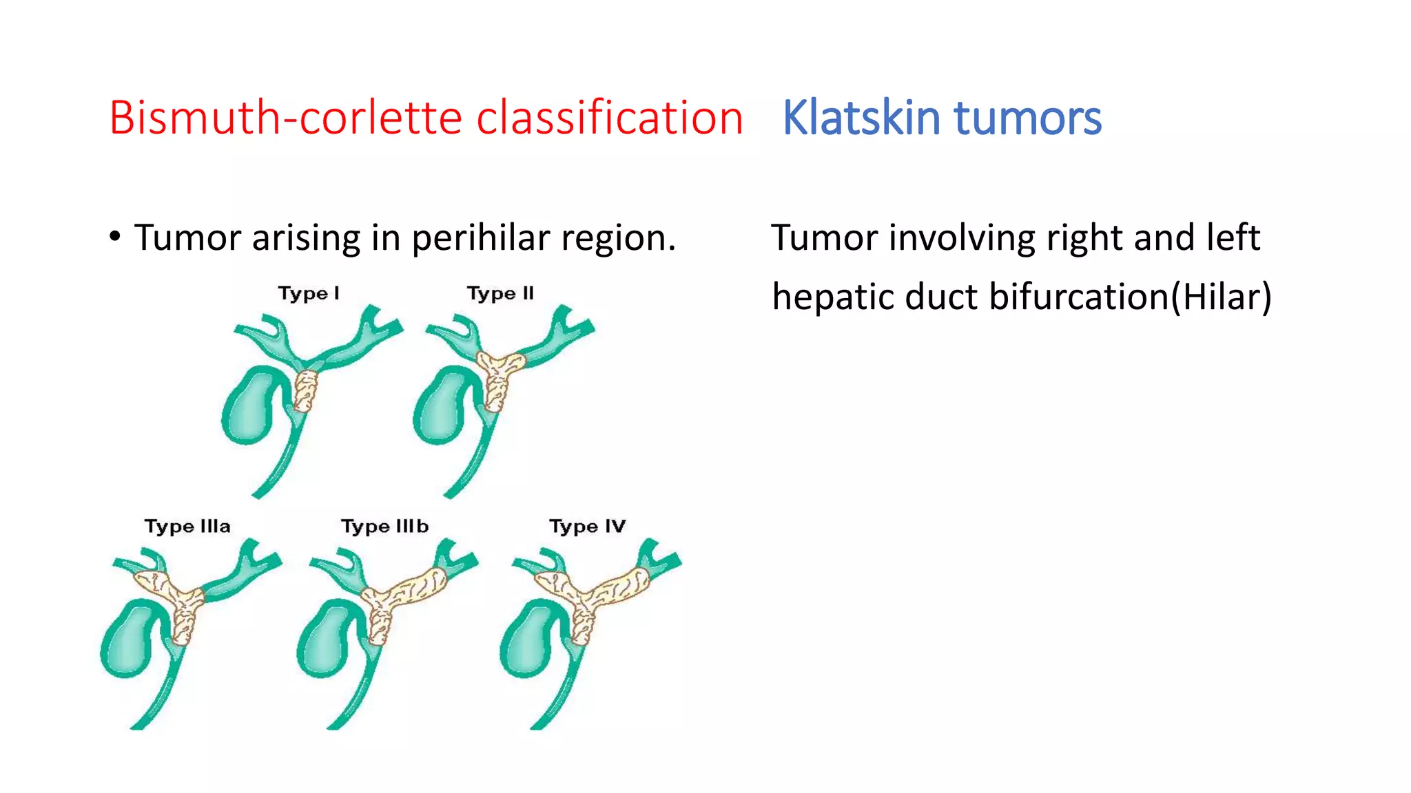 Cholangiocarcinoma | PPT
