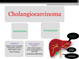 cholangiocarcinoma Sudhan Radiological Imaging | PPTX