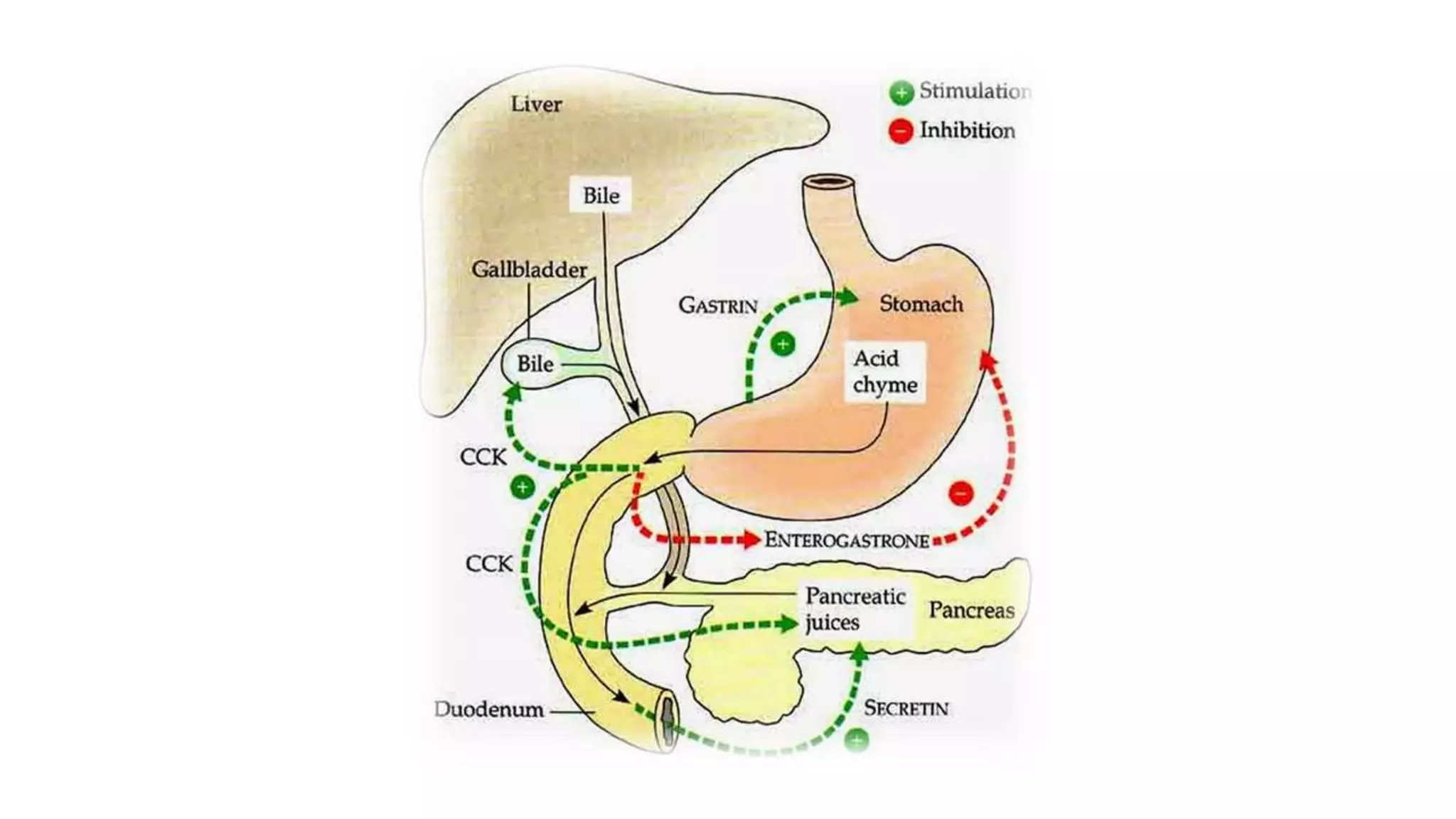 Acute Cholecystitis | PPTX