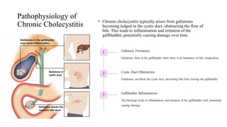 Chronic cholecystitis. Laparoscopic operations. Technique. Tools | PPTX