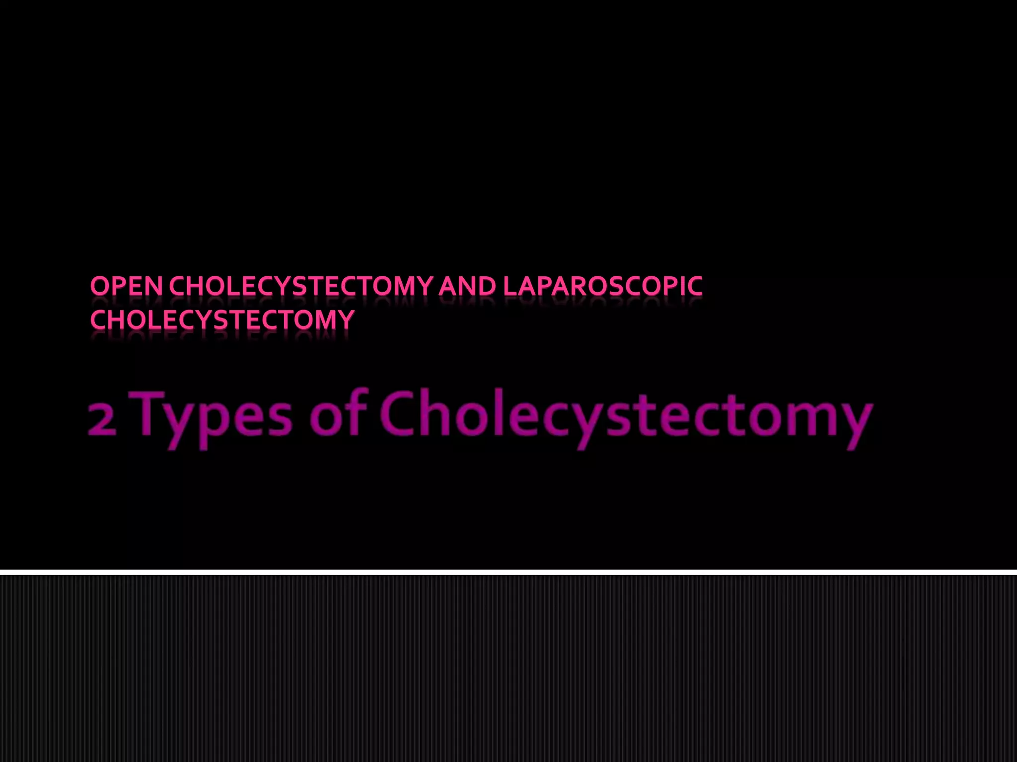 Cholecystectomy | PPTX