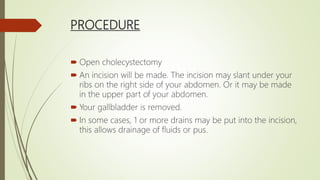 Cholecystectomy | PPTX