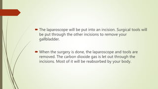 Cholecystectomy | PPTX