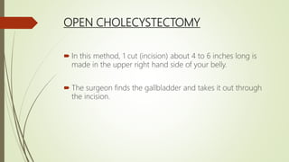 Cholecystectomy | PPTX