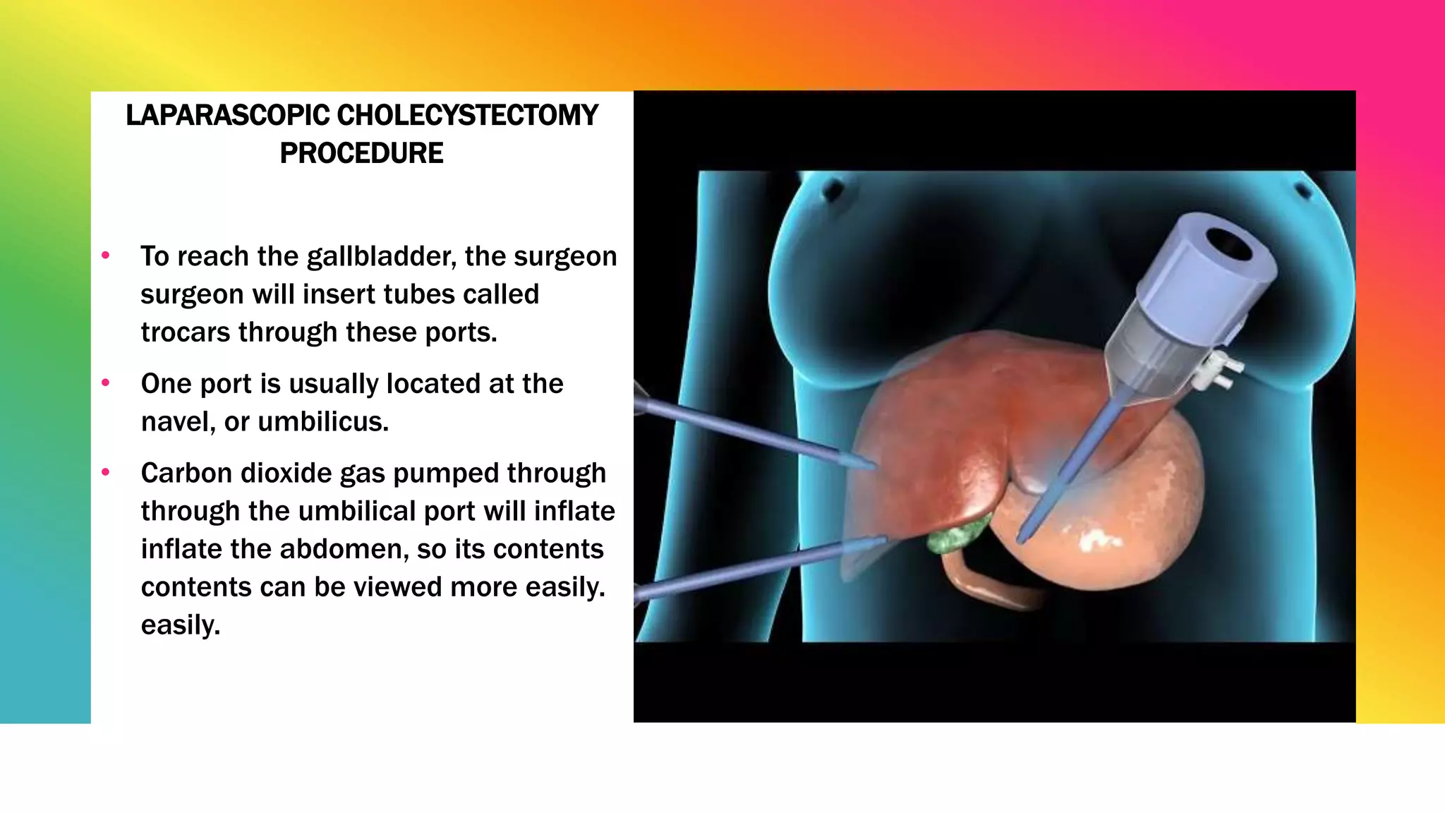 Cholecystectomy..pptx