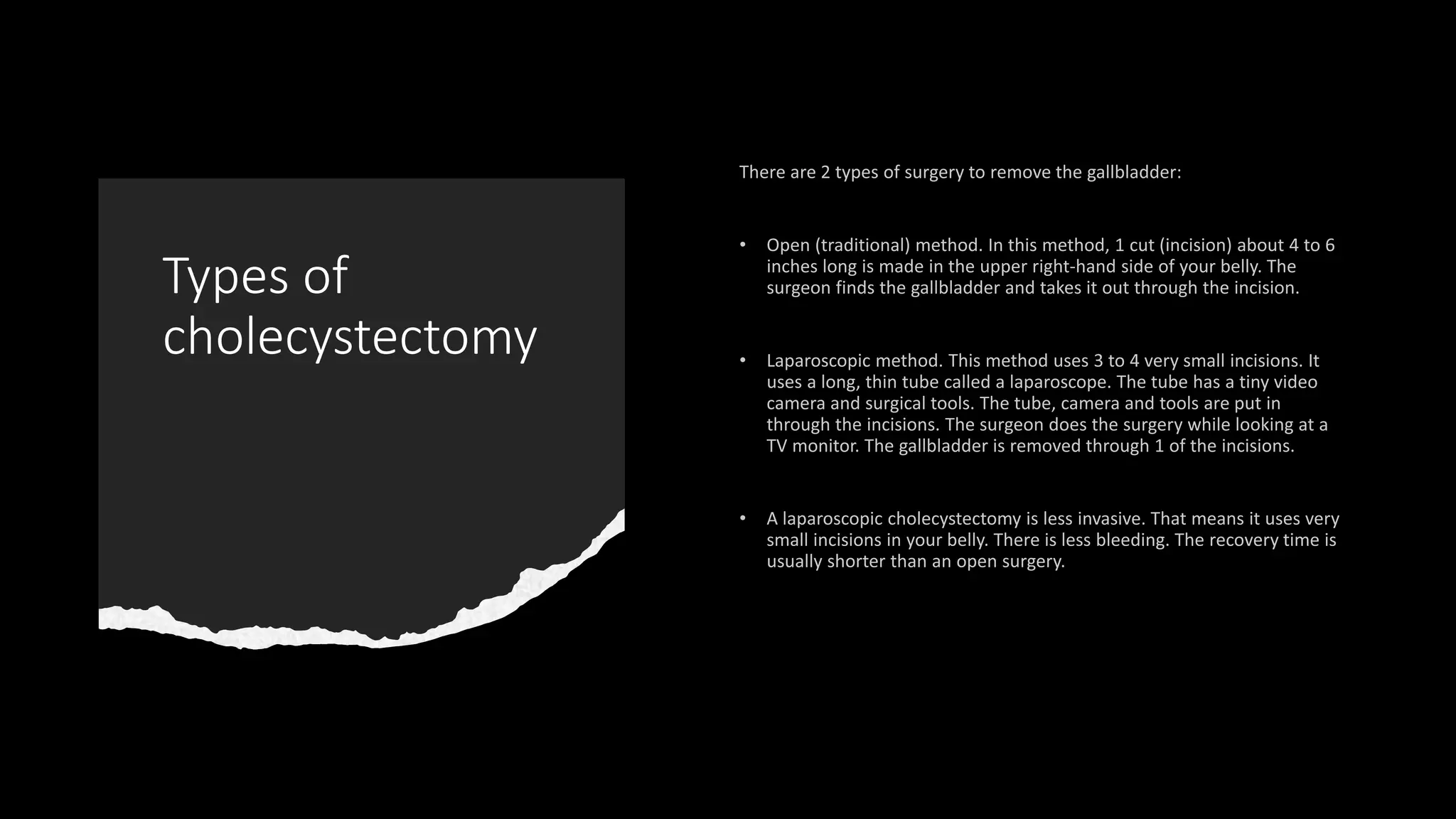 Cholecystectomy | PPTX