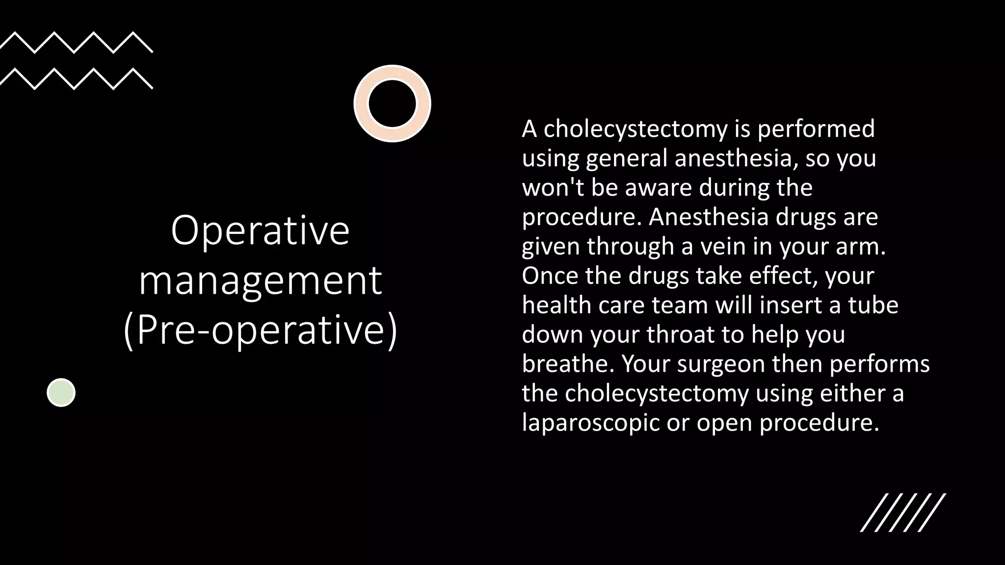 Cholecystectomy | PPTX