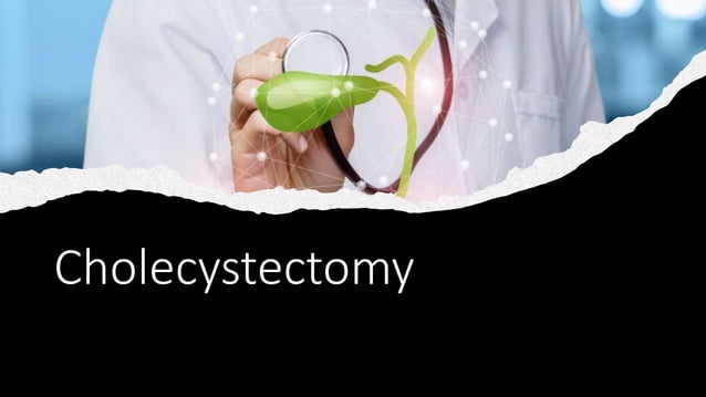 Cholecystectomy | PPTX | Surgery | Medical Health