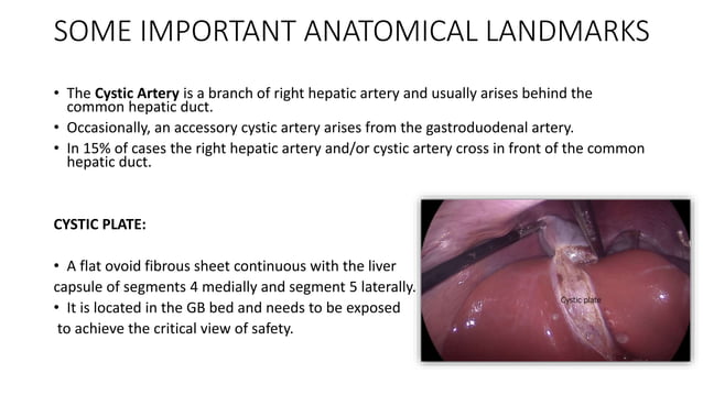 CHOLECYSTECTOMY - ANATOMY, TYPES, SURGICAL STEPS, ERRORS ...