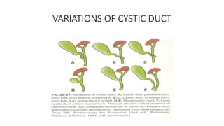 CHOLECYSTECTOMY - ANATOMY, TYPES, SURGICAL STEPS, ERRORS ...