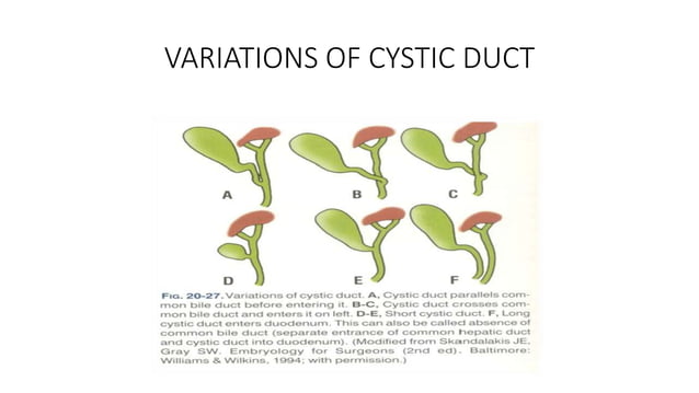 CHOLECYSTECTOMY - ANATOMY, TYPES, SURGICAL STEPS, ERRORS ...