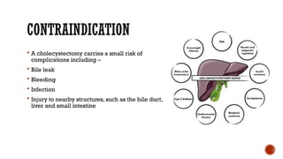 Cholecystectomy Definition, Types, Procedure | PPTX