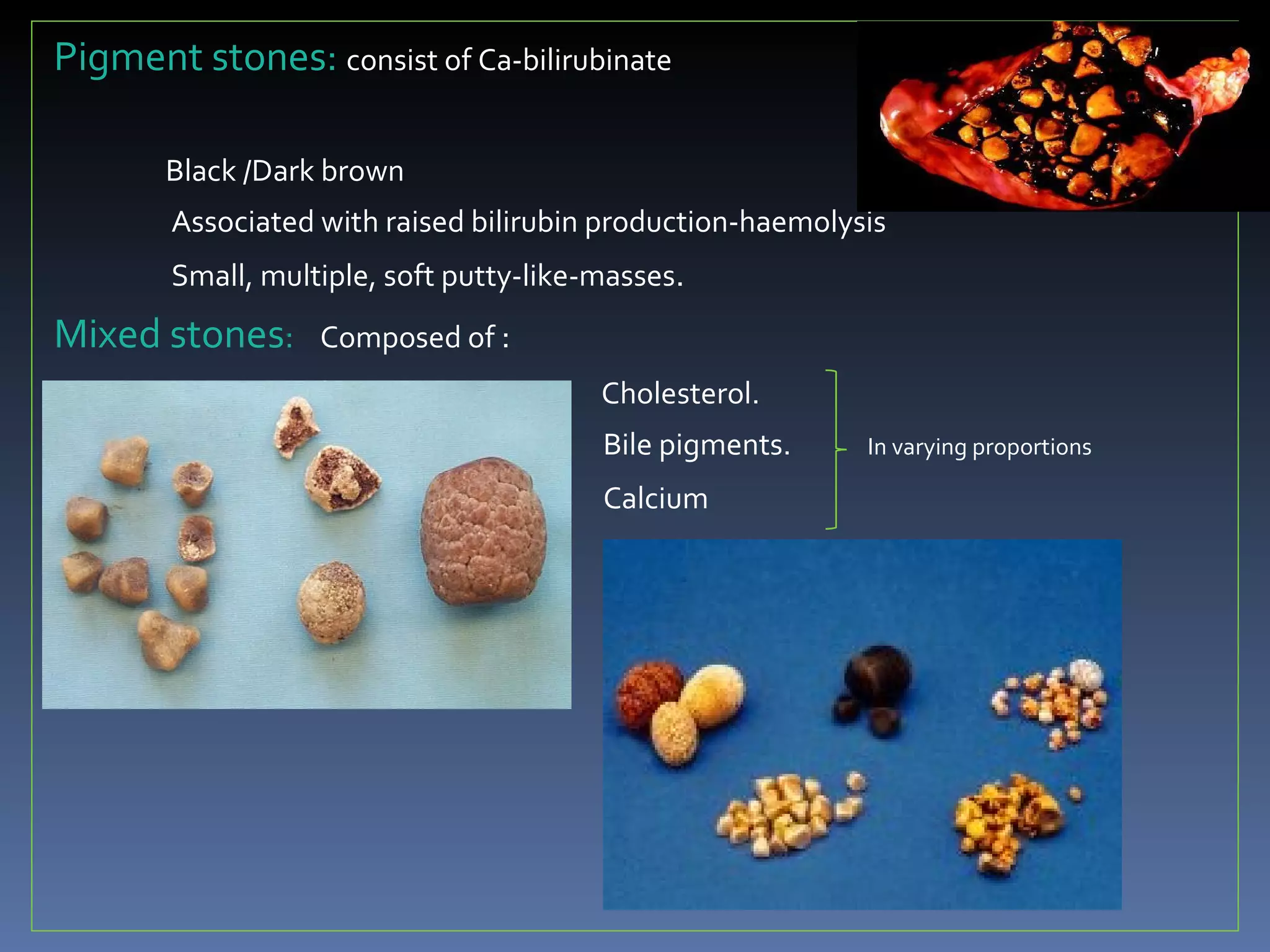 Cholecystitis | PPT