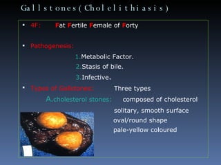 Cholecystitis | PPT