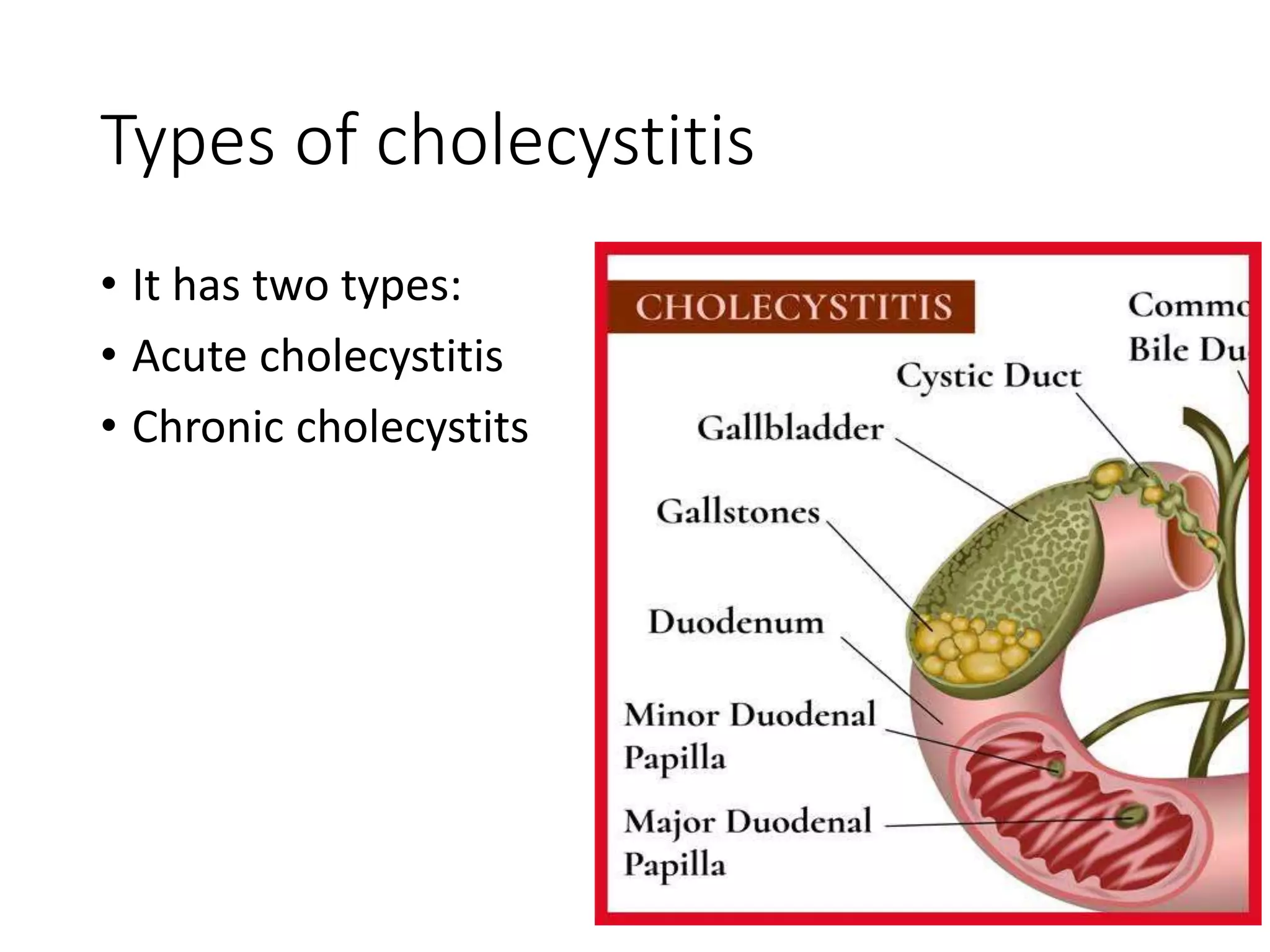 cholecystitis.pptx | Digestive Disorders | Diseases and Conditions