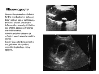 Cholecystitis(inflammation of the gall bladder).pptx