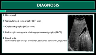 Pathophysiology of Cholecystitis and cholelithiasis | PDF