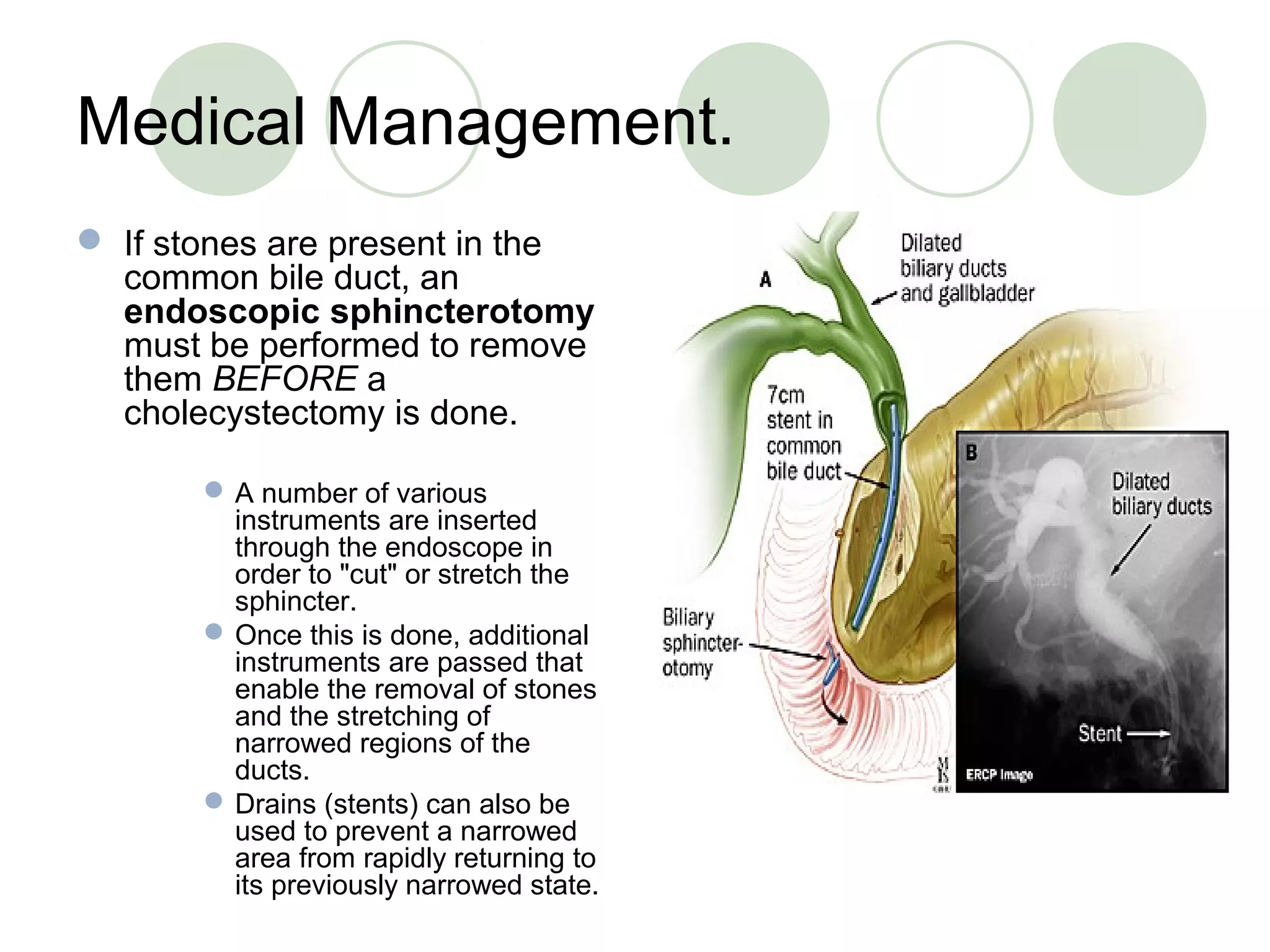 Cholecystitis cholelithiasis-presentation | PPT