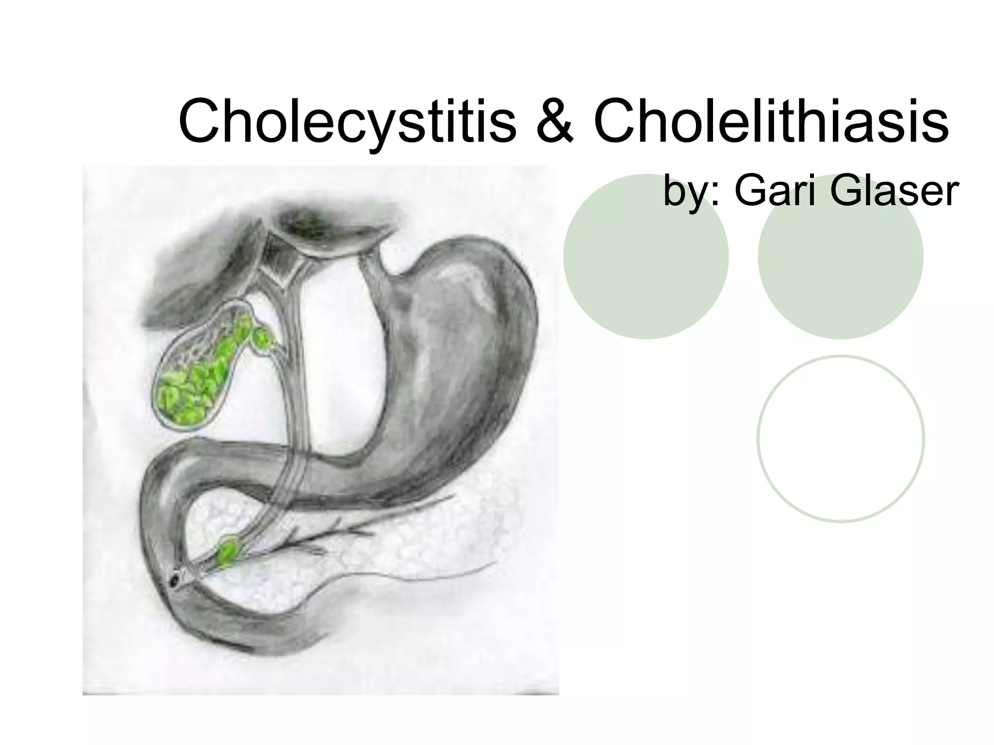 cholecystitis-cholelithiasis-presentation.ppt