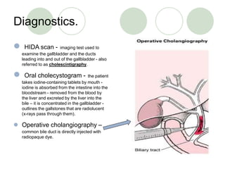 cholecystitis-cholelithiasis-presentation.ppt