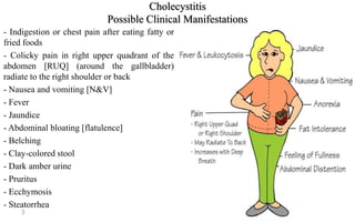 Cholecystitis and cholelithiasis | PPTX