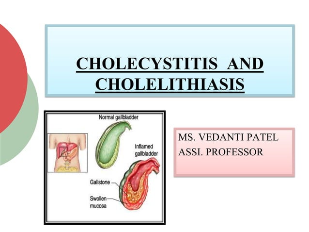 Cholecystitis And Cholelithiasis slideshare | PPTX | Digestive Disorders | Diseases and Conditions