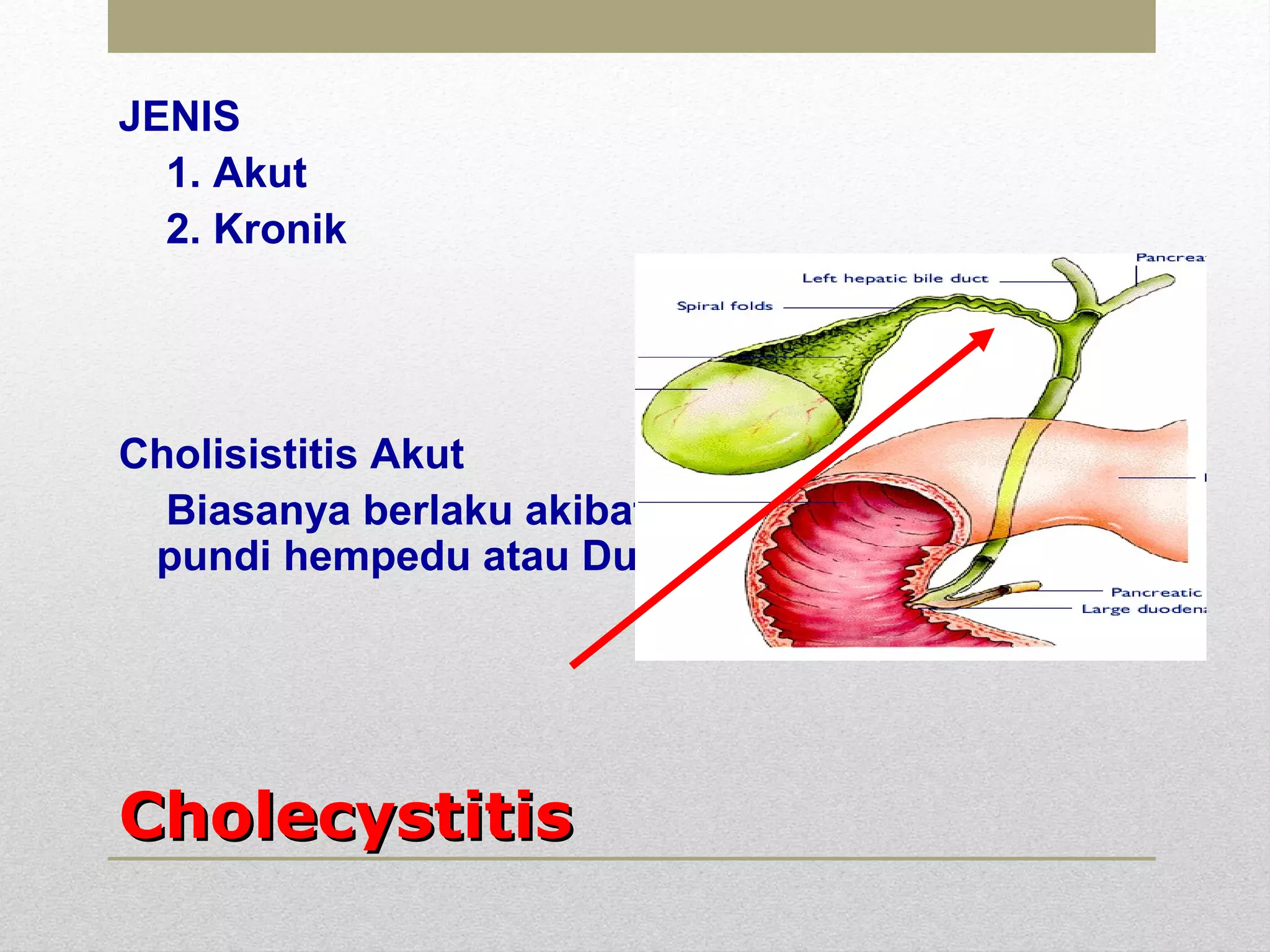 CHOLECYSTITIS dan CHOLELITHIASIS | PPT