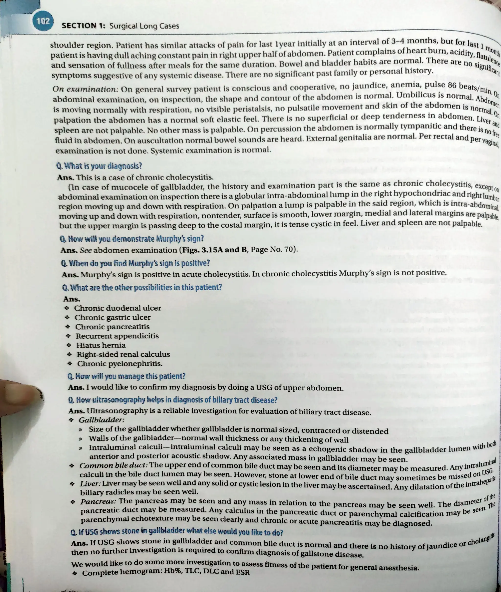 cholecystitis pdf.pdf